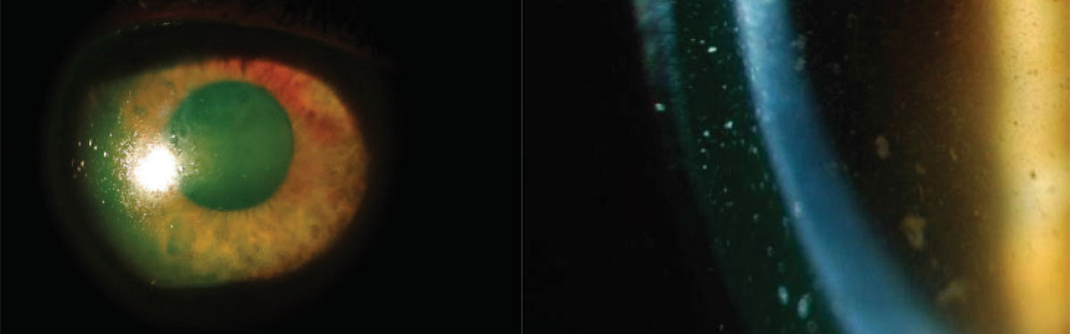 Eye Care Practitioner Resources | Blog – Tangible Science