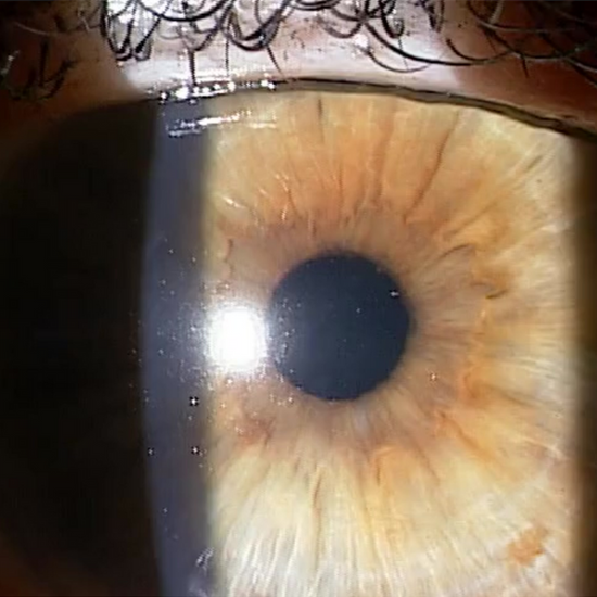 What is Tangible Hydra-PEG? | A Surface Coating To Solve Your Contact ...