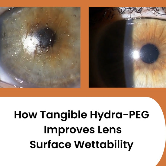 Patient Resources | Contact Lens Information – Tangible Science