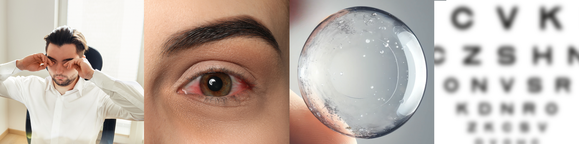 What Causes Common Contact Lens Problems | Tangible Science